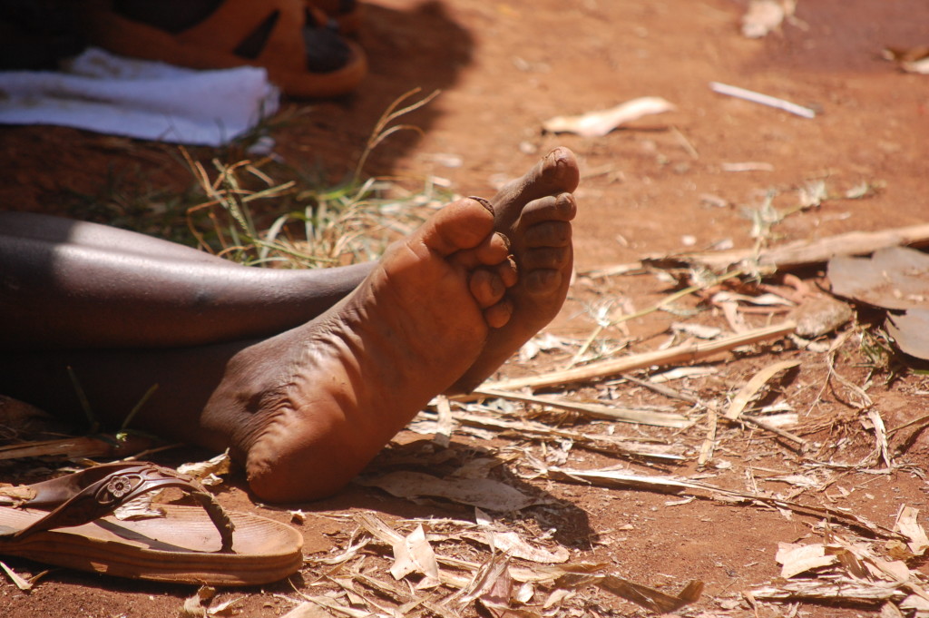 Jigger removal campaign begins | Saved By God's Grace